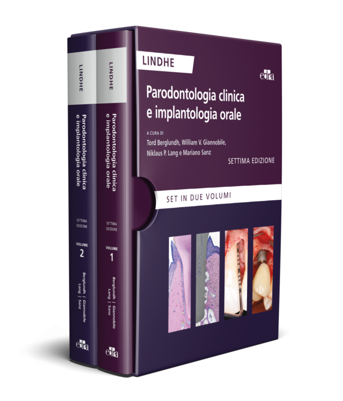 Parodontologia clinica e implantologia orale di Lindhe – Pubblicazioni ...